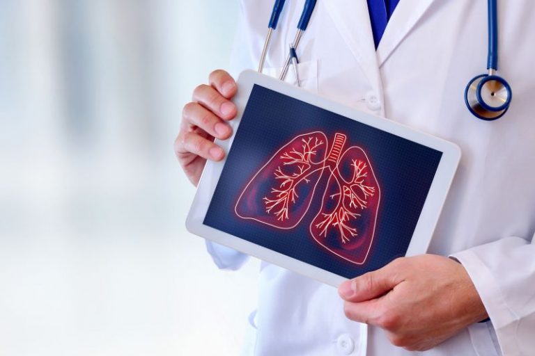 Program wykrywania raka płuca. Niskodawkowa tomografia NDTK Program wykrywania raka płuca. Niskodawkowa tomografia NDTK